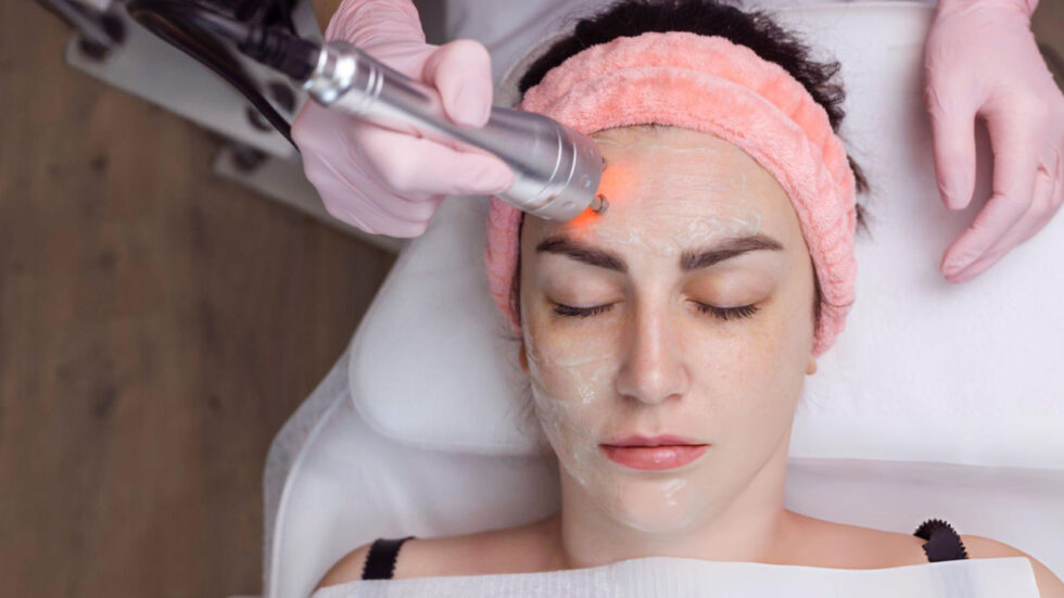 Non-Surgical Bio-lifting Facial in Calgary | Marvy's Skincare